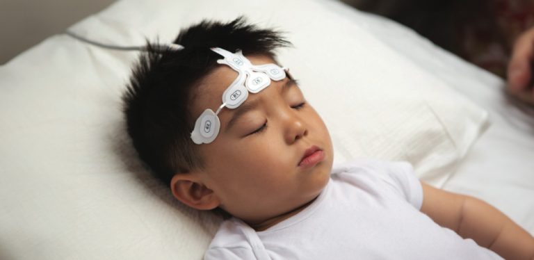 SEDLINE e o PSI na monitorização da profundidade anestésica | MA Hospitalar