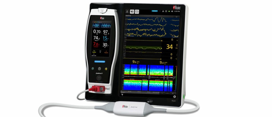 Patient State Index (PSI): como a tecnologia auxilia no monitoramento?